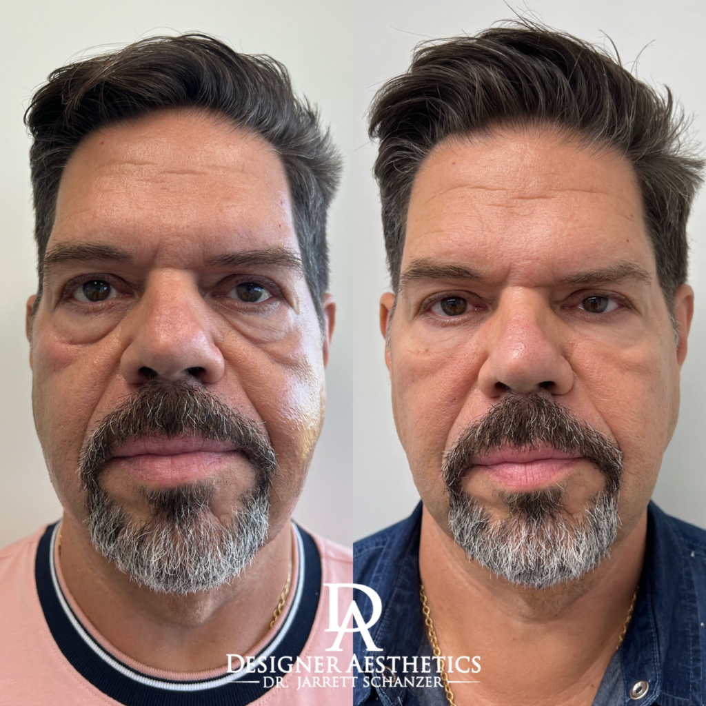 Facial balancing / full face rejuvenation - Designer Aesthetics by Dr ...